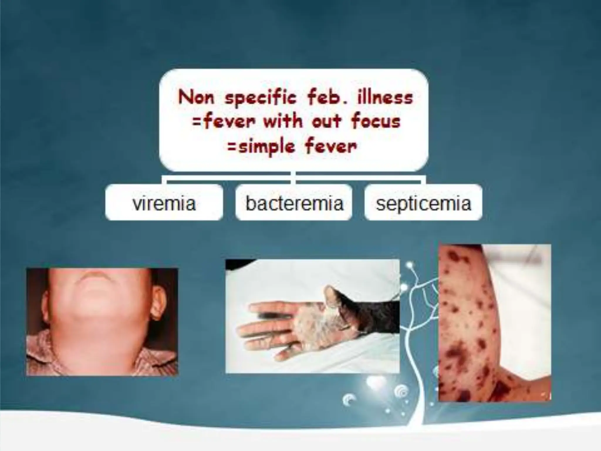 new update Short febril illness 2024 New.ppt