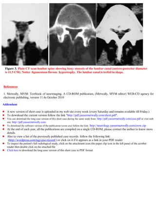 Short case...Lumbar canal stenosis | PDF
