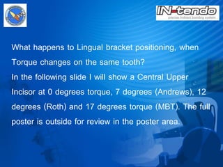 Short lecture 20 mins "Lets talk about torque in Lingual Orthodontics ...