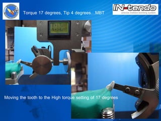 Short lecture 20 mins "Lets talk about torque in Lingual Orthodontics ...