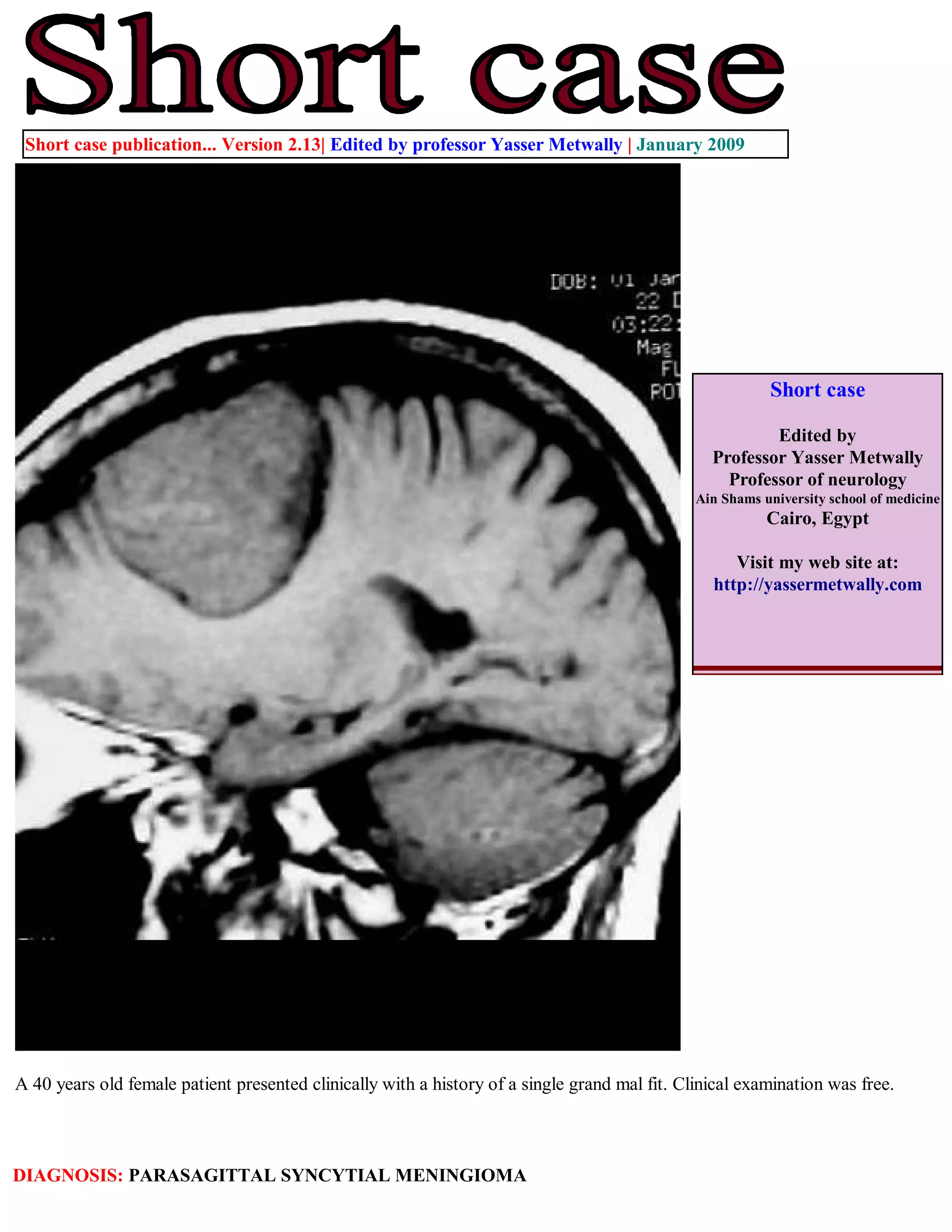 Short case...Parasagittal meningioma | PDF
