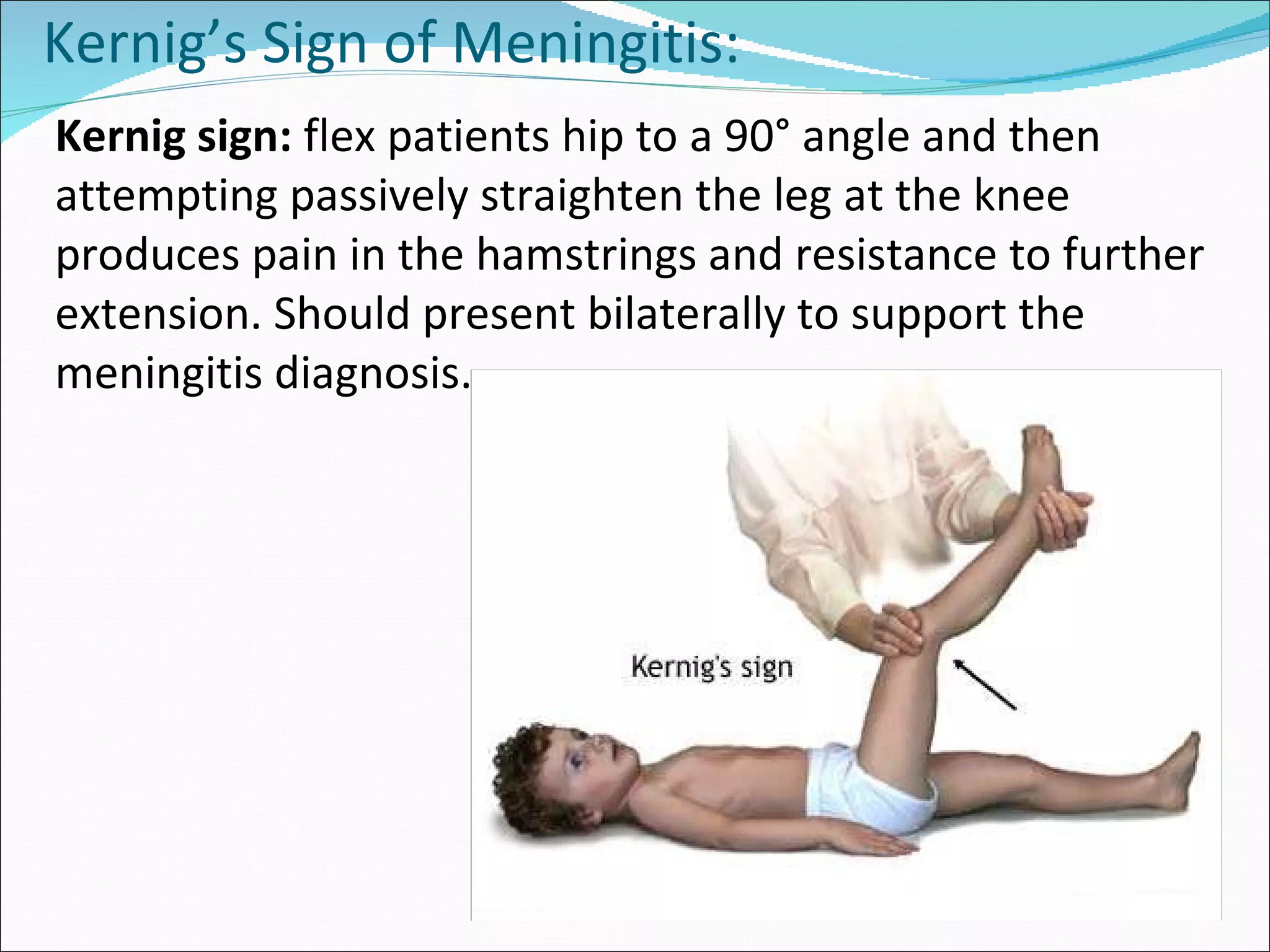 Short presentation version cns infections Lecture | PPT