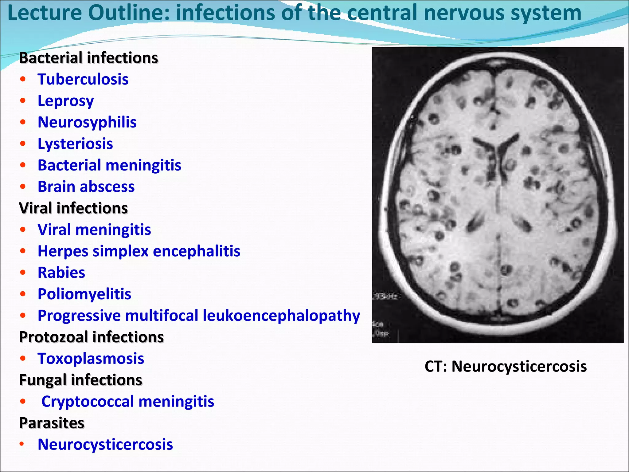 Short presentation version cns infections Lecture | PPT
