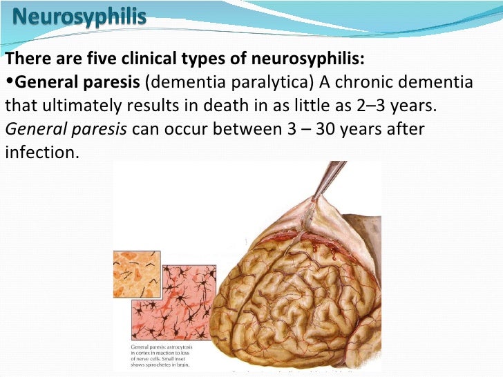 Short presentation version cns infections Lecture