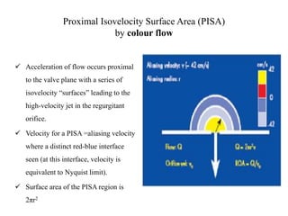 Echocardiography assessment of Aortic Regurgitation severity | PPTX