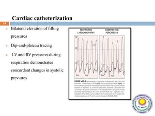 Short review cardiac amyloidosis and recent advances | PPTX