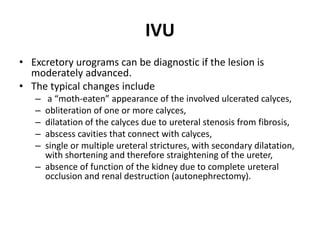 Short review of genitourinary tuberculosis | PPTX