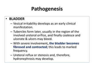 Short review of genitourinary tuberculosis | PPTX