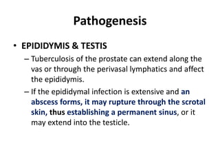 Short review of genitourinary tuberculosis | PPTX