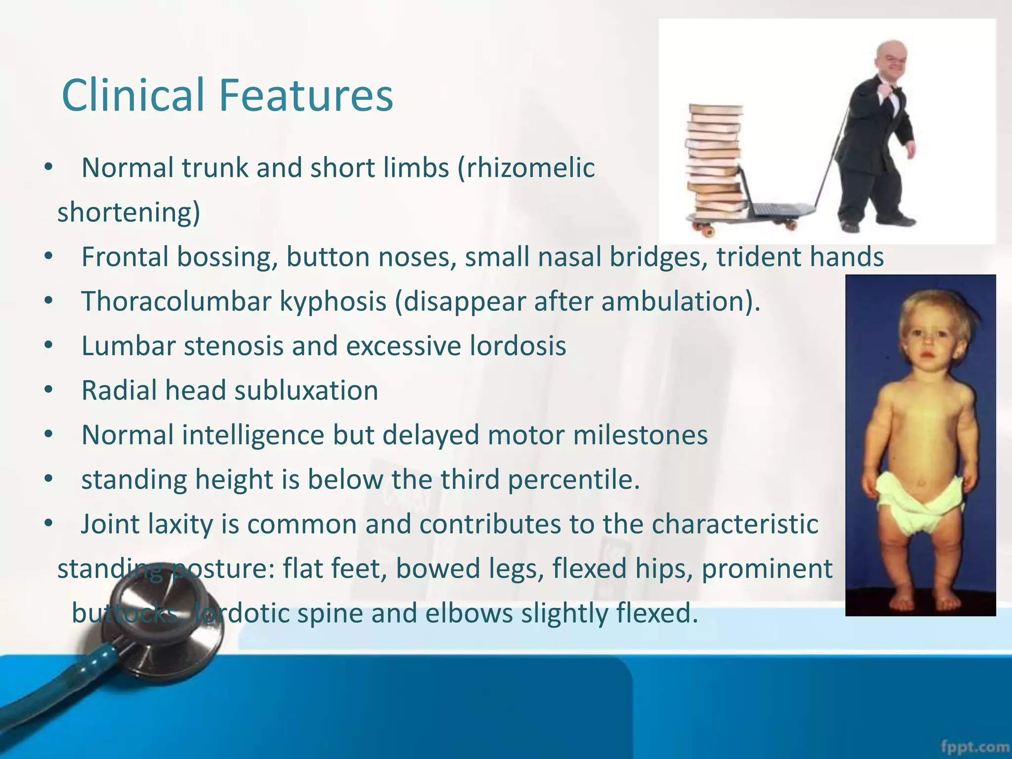 Short stature | PPTX | Endocrine and Metabolic Diseases | Diseases and ...