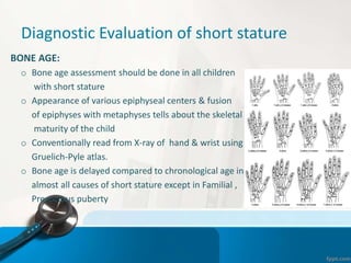 Short stature | PPTX