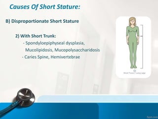 Short stature | PPTX