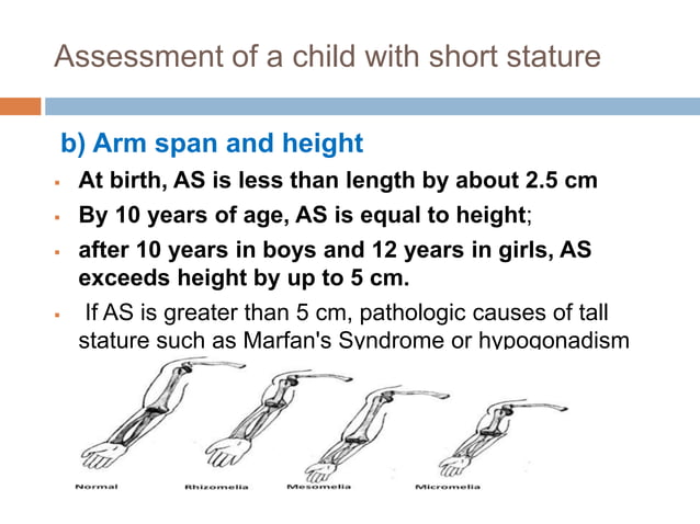 shortstature.ppt