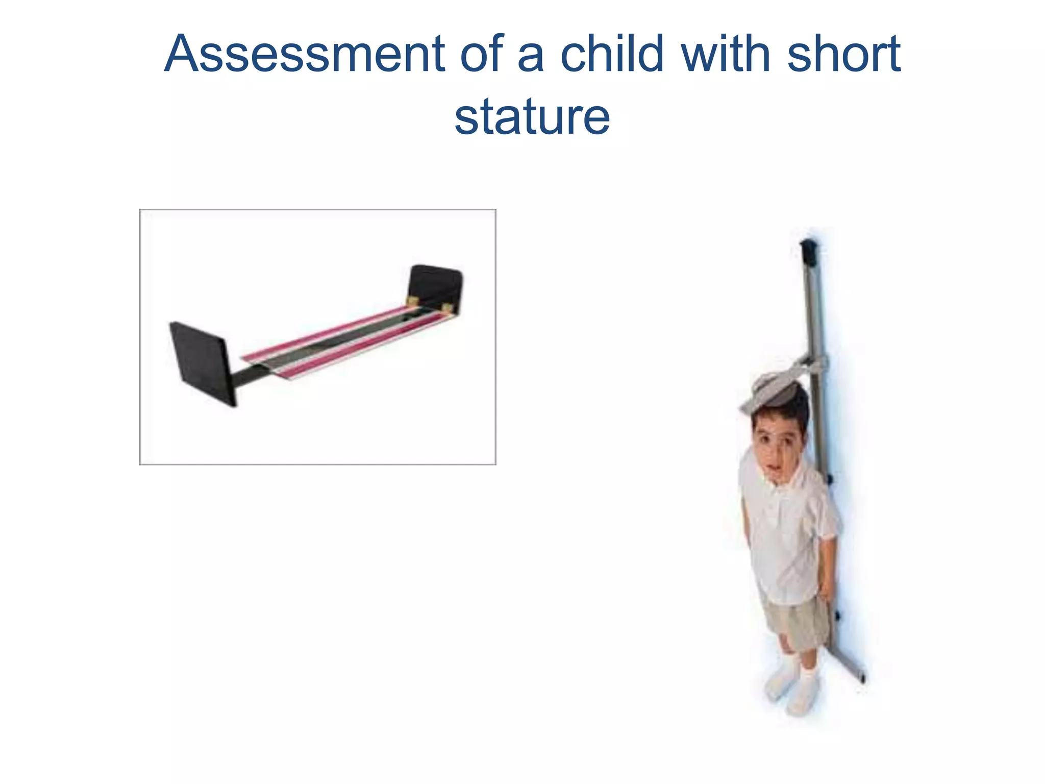Approach to child with short stature | PDF