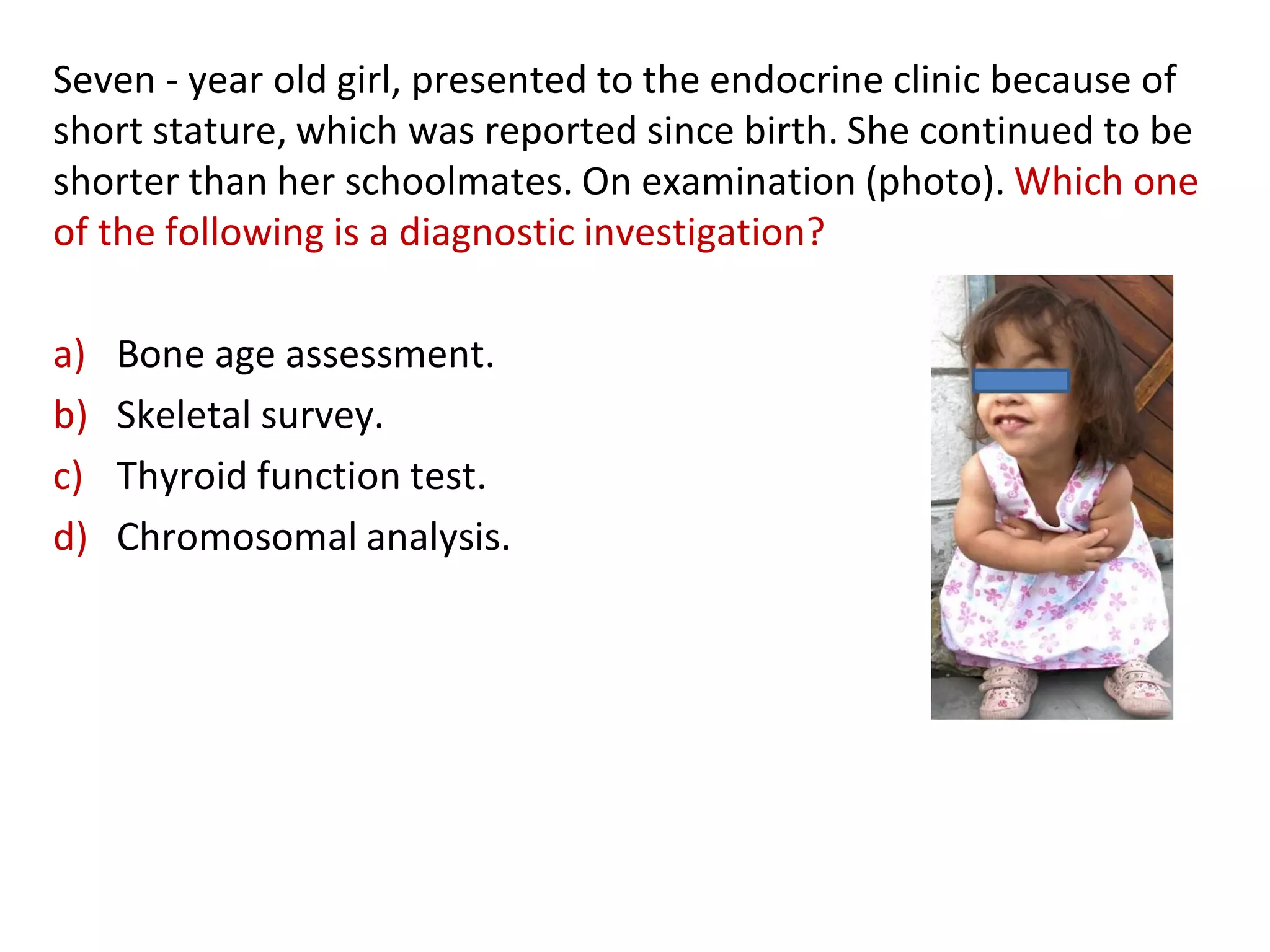 Short stature definition and approach | PDF
