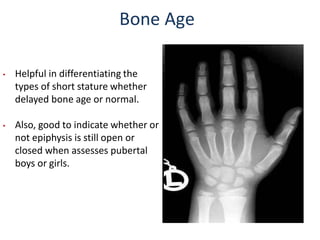 Short stature definition and approach | PDF