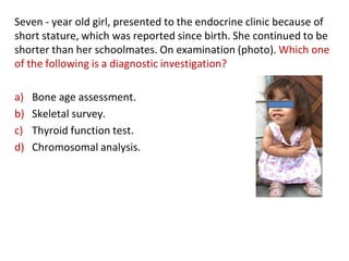 Short stature definition and approach | PDF