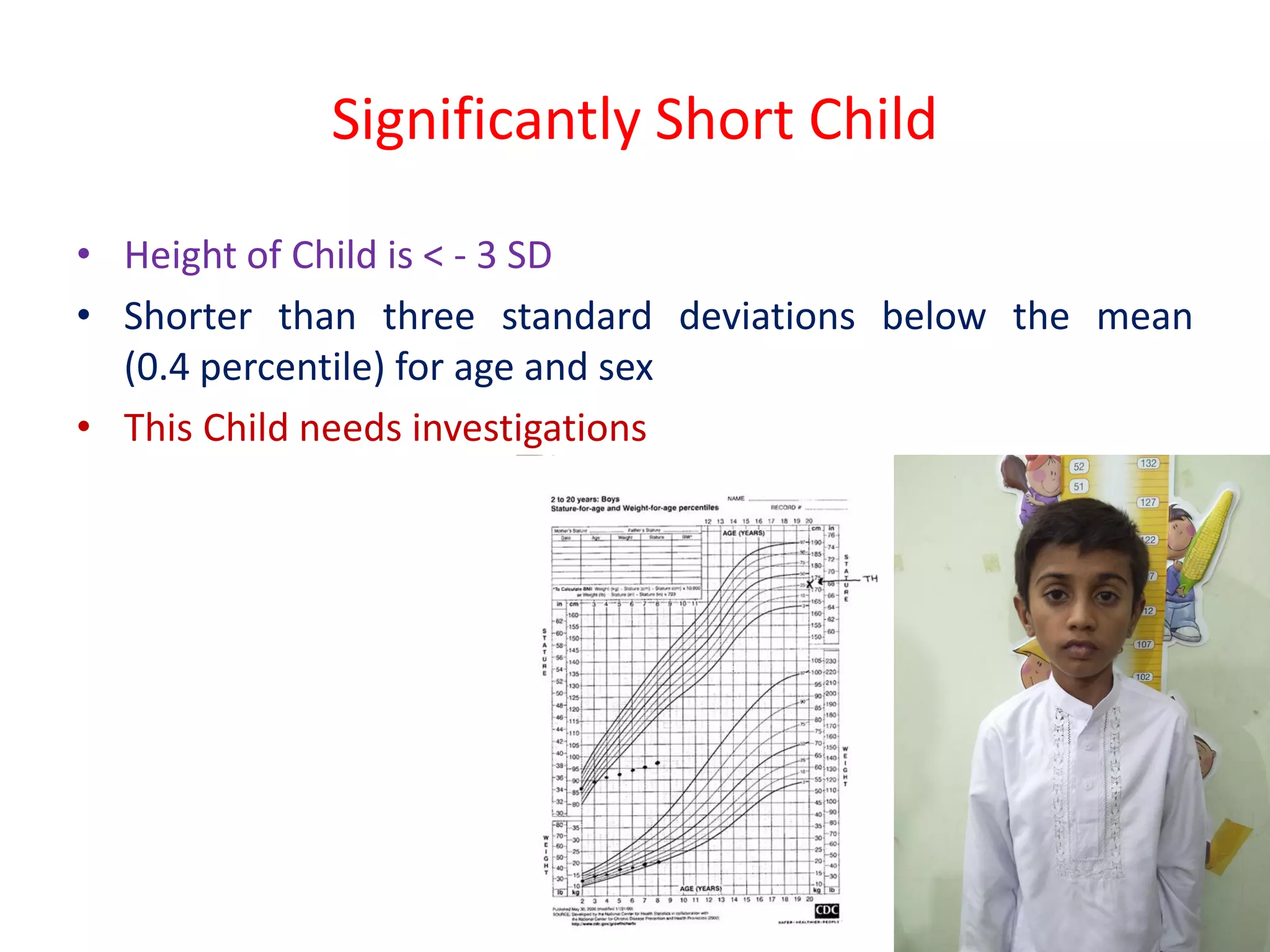 Short stature in children 2021 | PDF