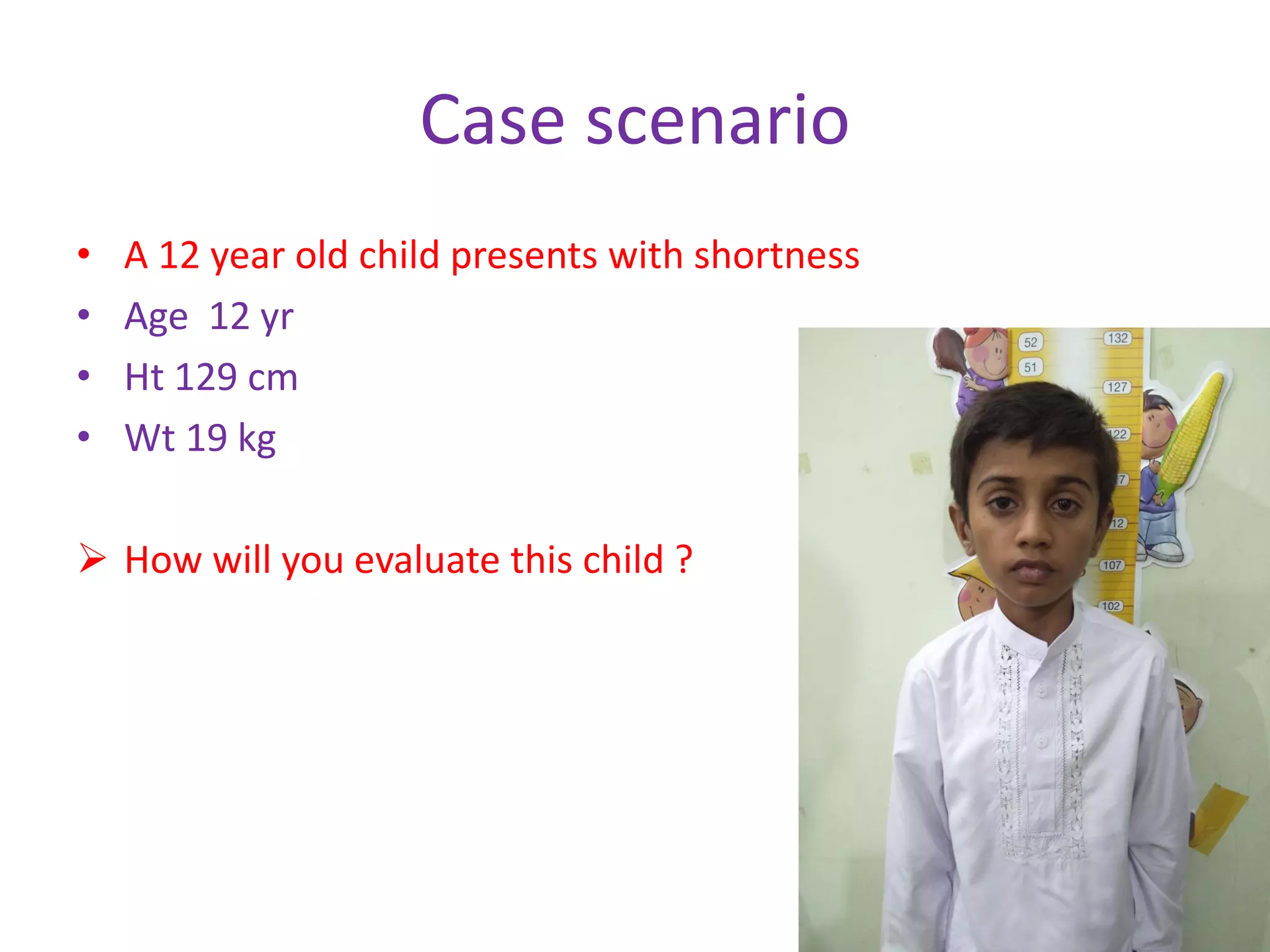 Short stature in children 2021 | PDF