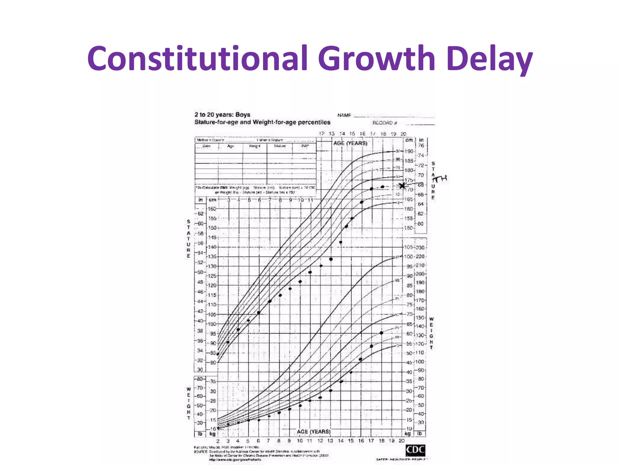 Short stature in children 2020 | PDF