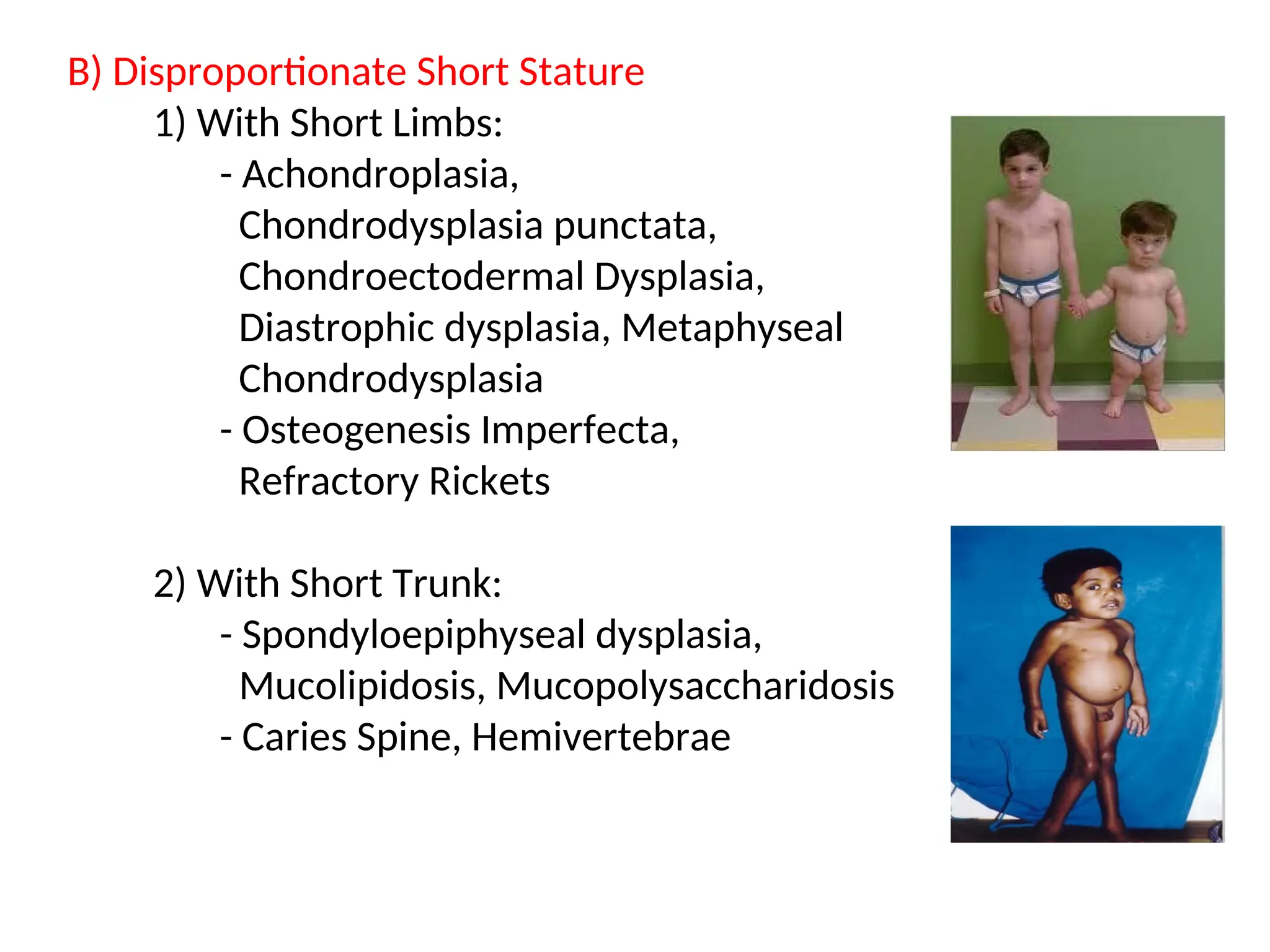 How to work up short stature in Children .ppt