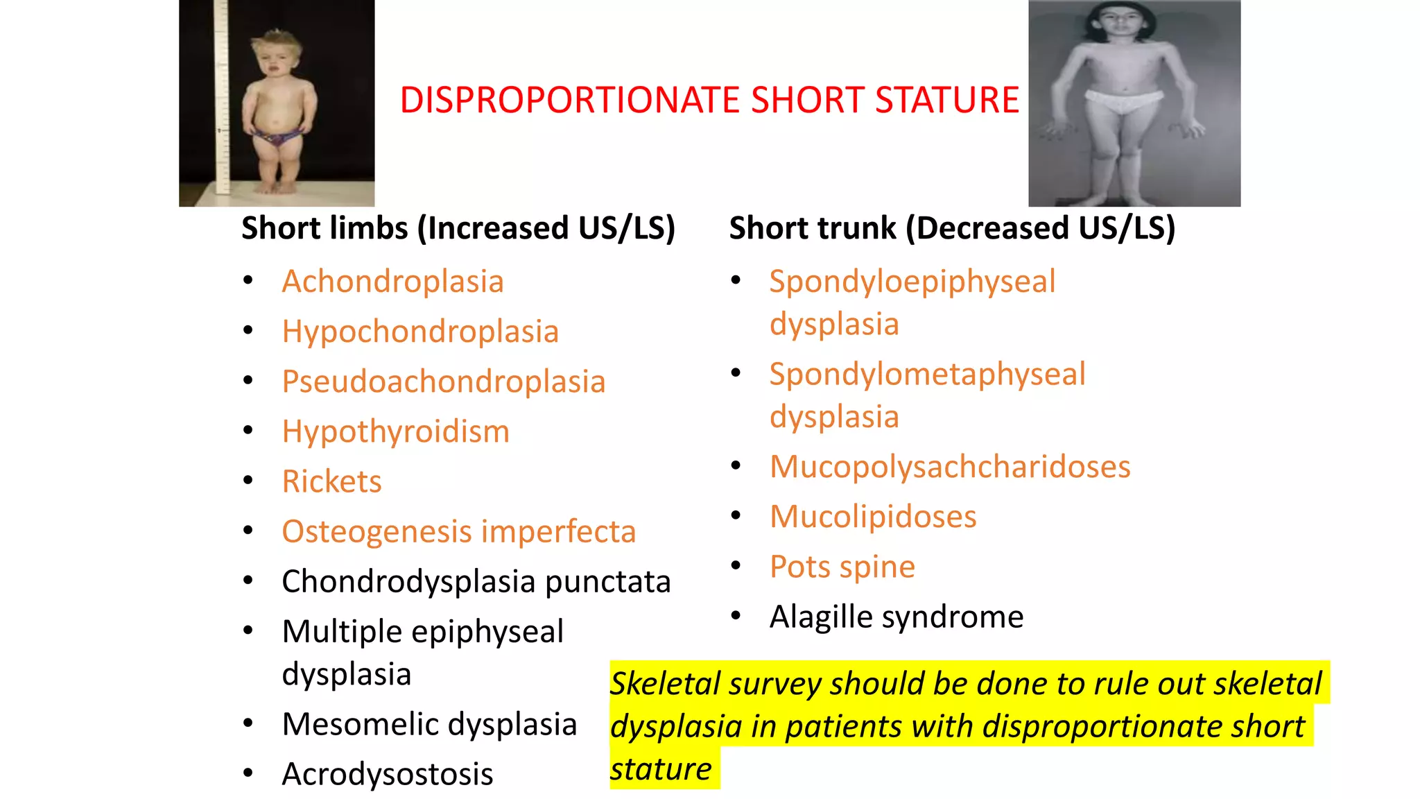 Short stature | PPTX