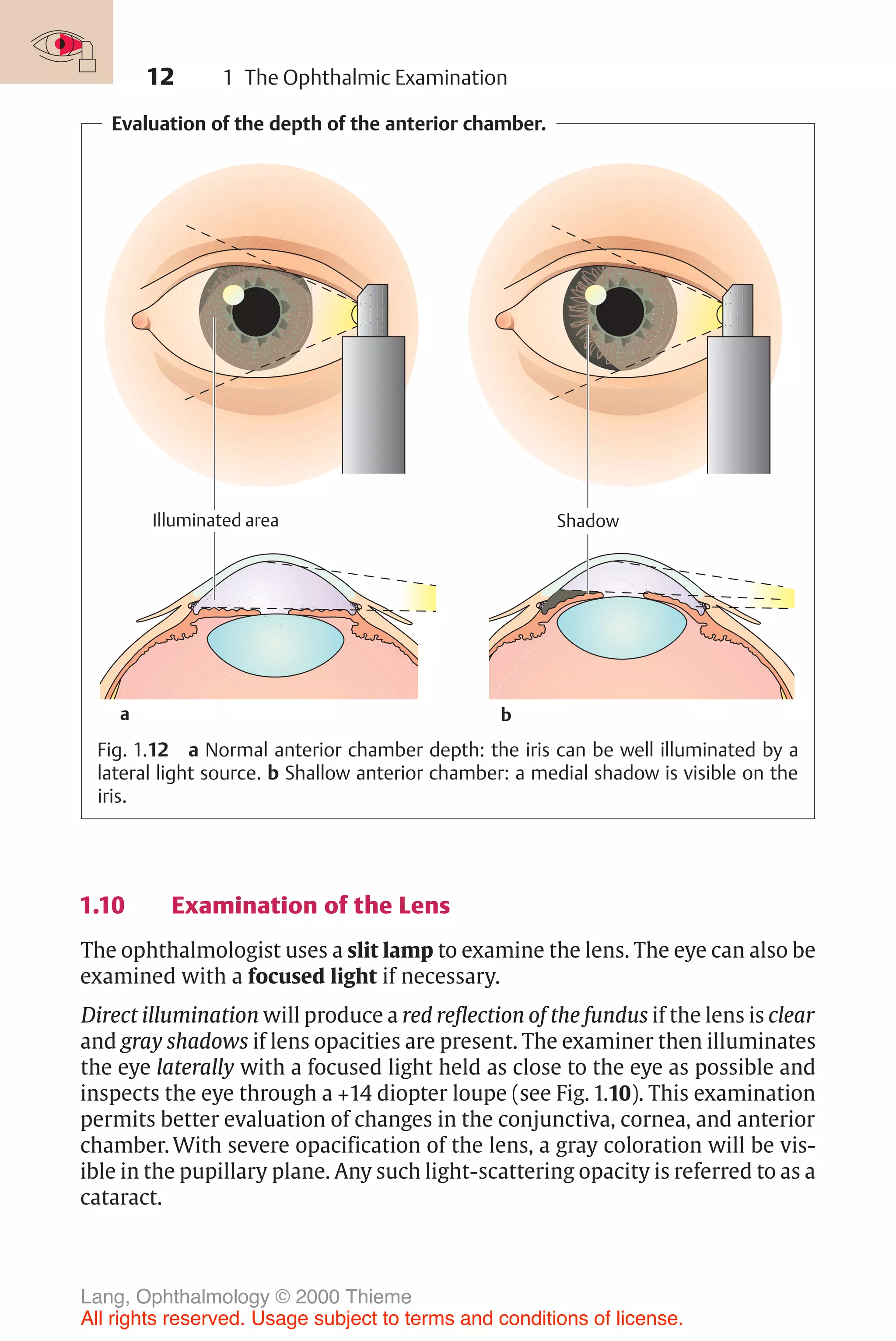 ShortTexet Lang Ophthalmology © 2000 Thieme.pdf