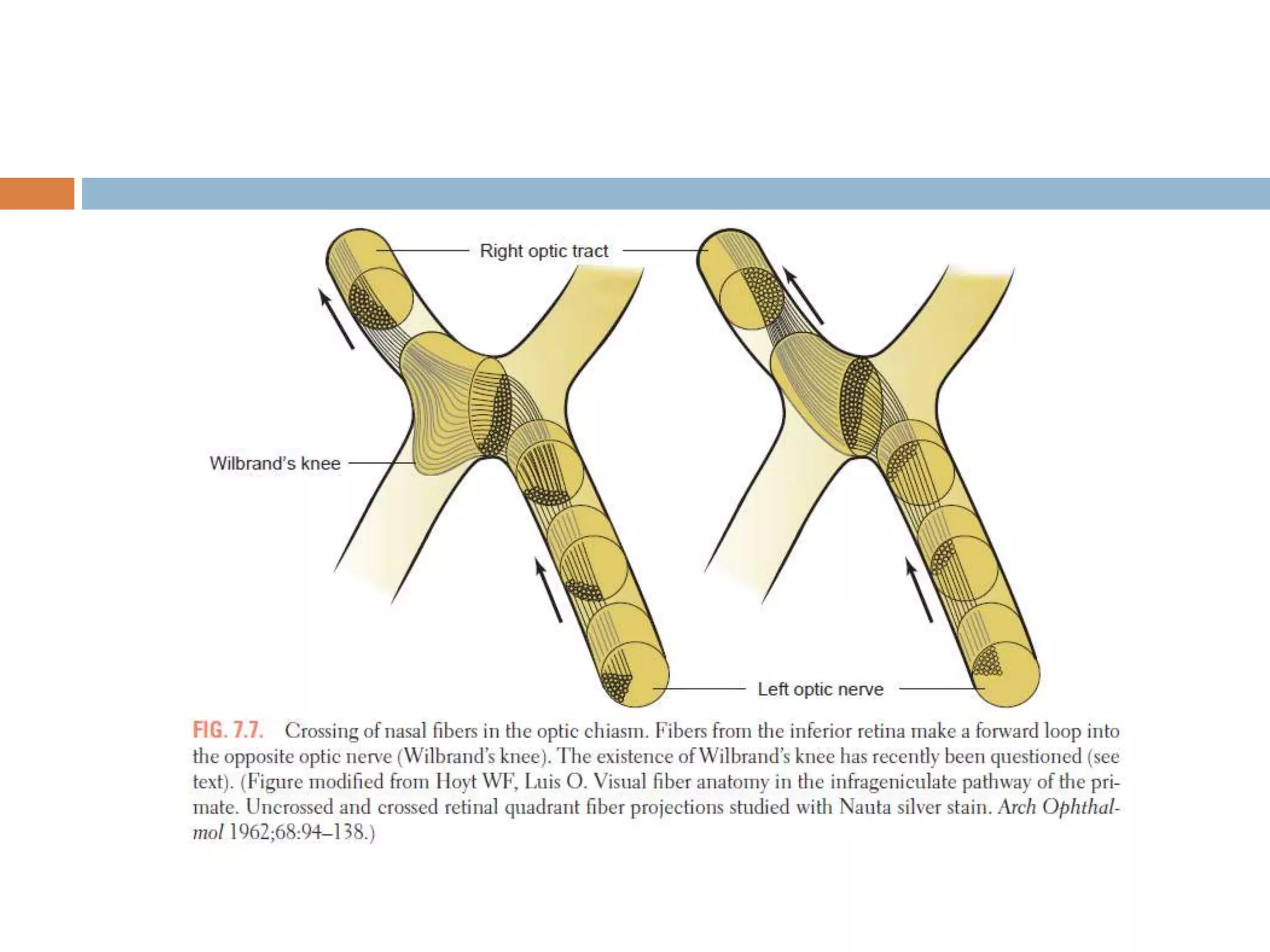 Cranial Nerves - Olfactory Optic Oculomotor Abducent Trochlear | PPTX