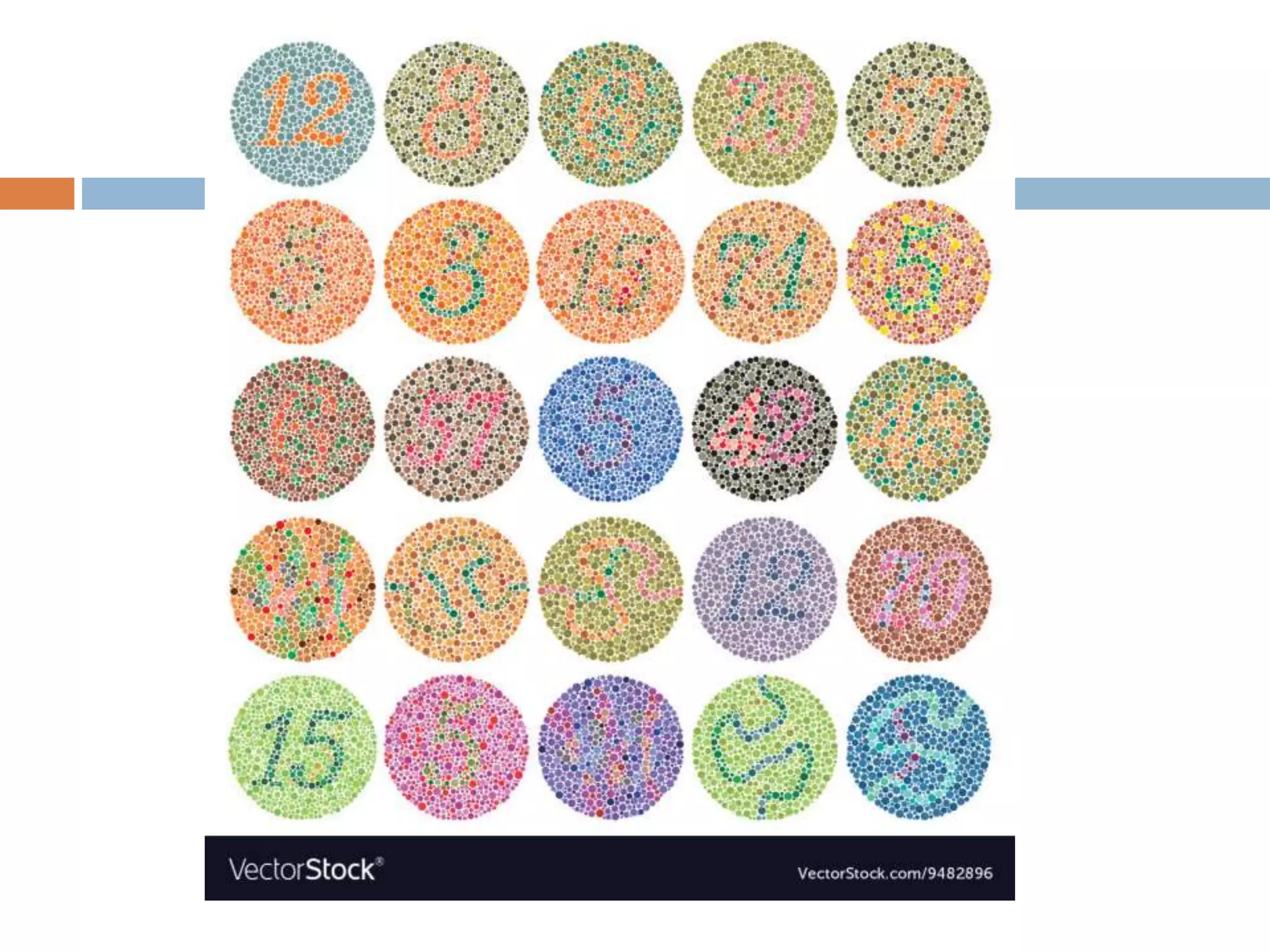Cranial Nerves - Olfactory Optic Oculomotor Abducent Trochlear | PPTX