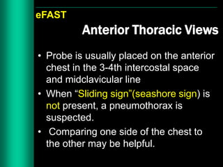 Imaging in abdominal trauma | PPTX