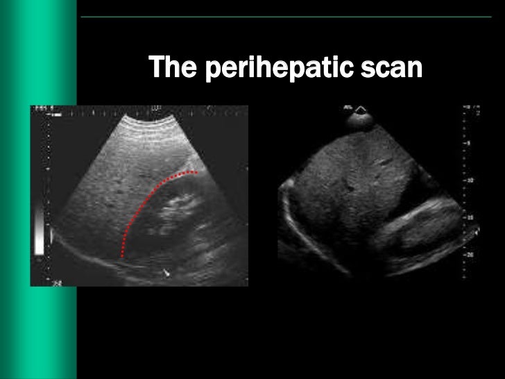 Imaging in abdominal trauma