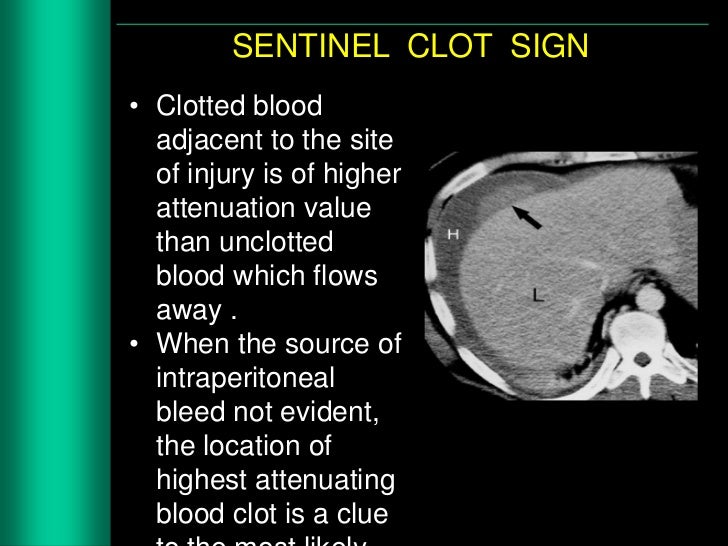 Imaging in abdominal trauma