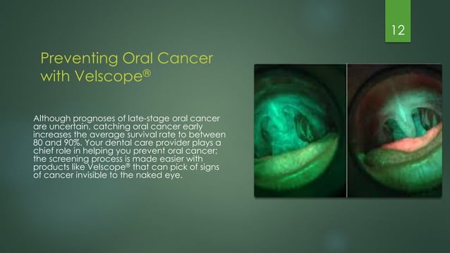 short presentation about VELscope | PDF