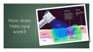 short presentation about VELscope | PDF