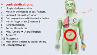 Short wave diathermy | PPTX