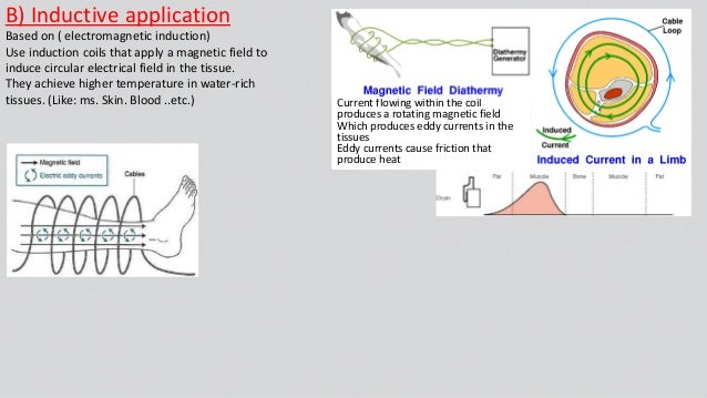 Short wave diathermy