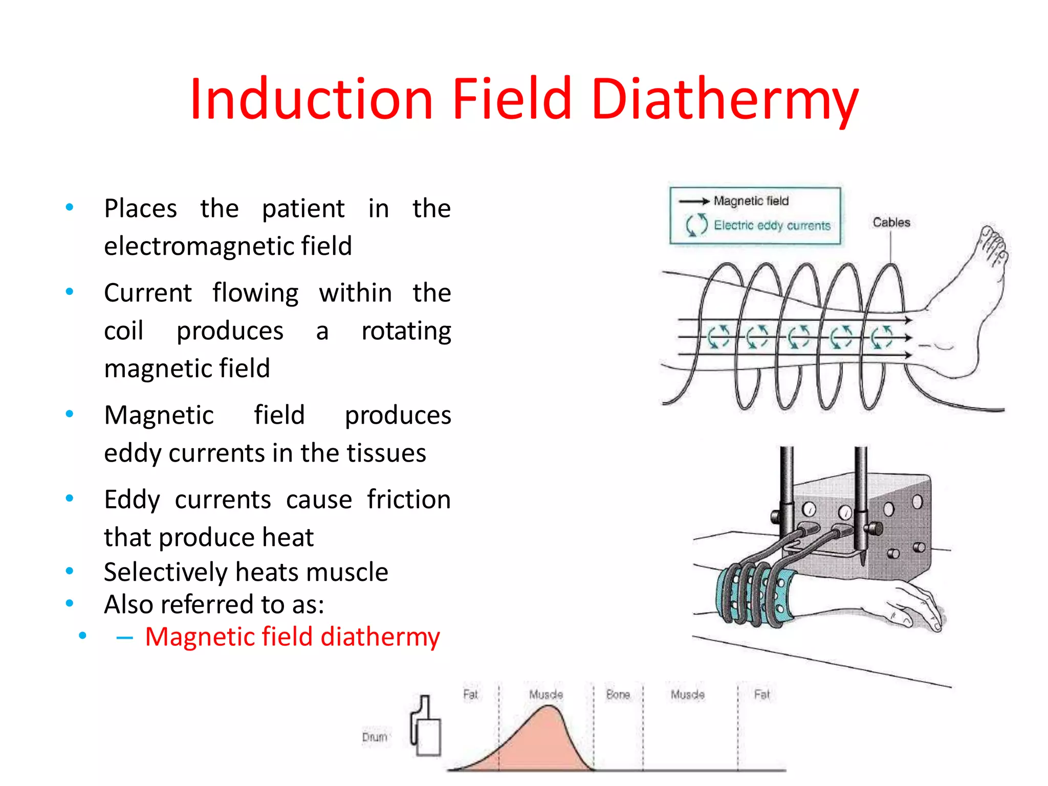 Shortwave diathermy | PPTX
