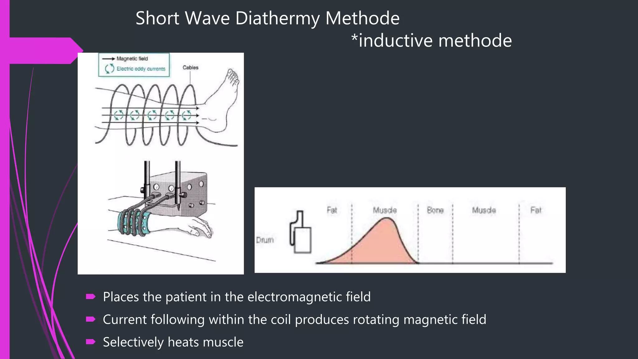 Short wave diathermy | PPT