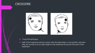 Short wave diathermy | PPT