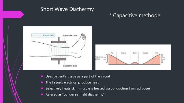 Short wave diathermy