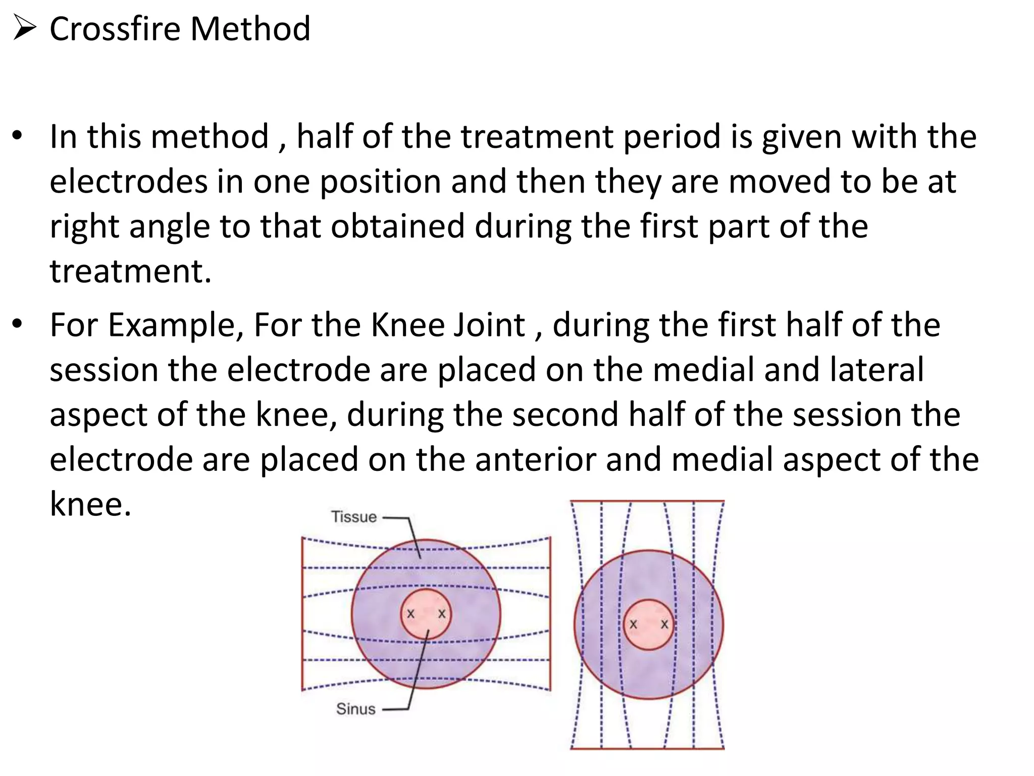 Short wave diathermy (s.w.d) electro therapy | PPTX