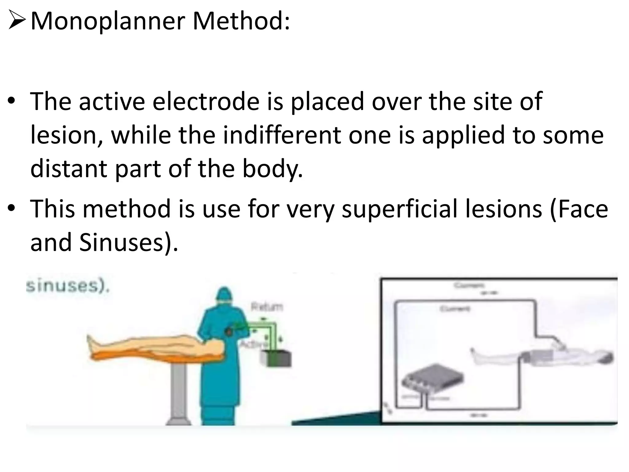 Short wave diathermy (s.w.d) electro therapy | PPTX