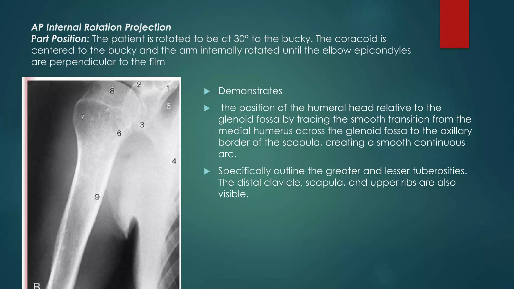RADIOLOGICAL ANATOMY OF UPPER LIMB(SHOULDER@ELBOW) | PPTX
