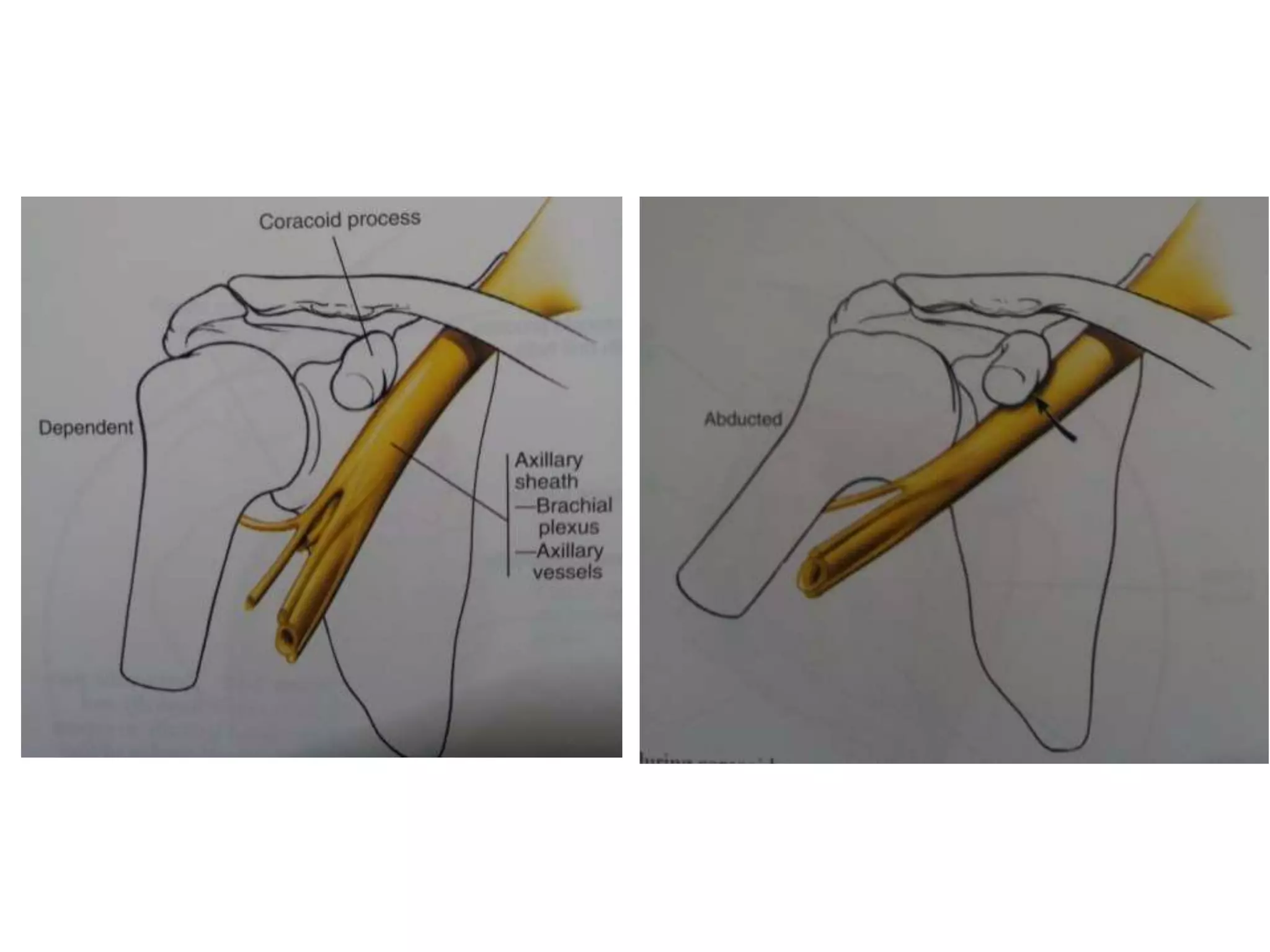 Shoulder | PPT | Free Download