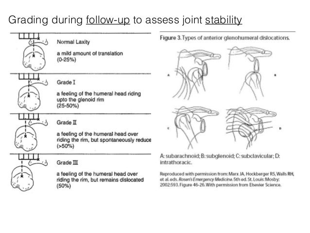 Shoulder Instability Grading Current Concepts In Chronic Traumatic