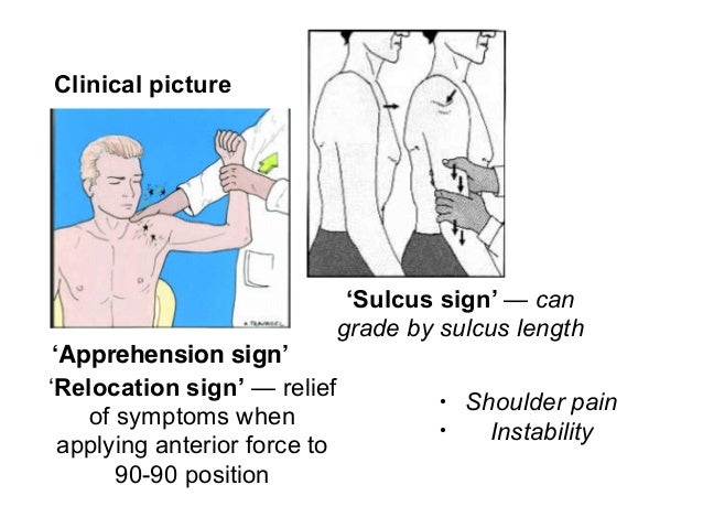 Shoulder anatomy and pathology
