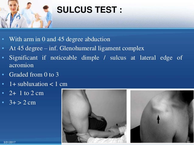 Shoulder dislocation Co Norbert