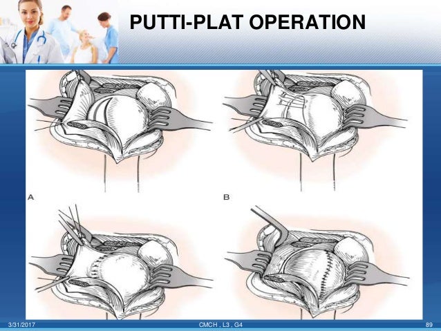 Shoulder dislocation Co Norbert
