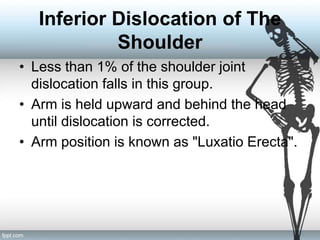 Shoulder | PPT