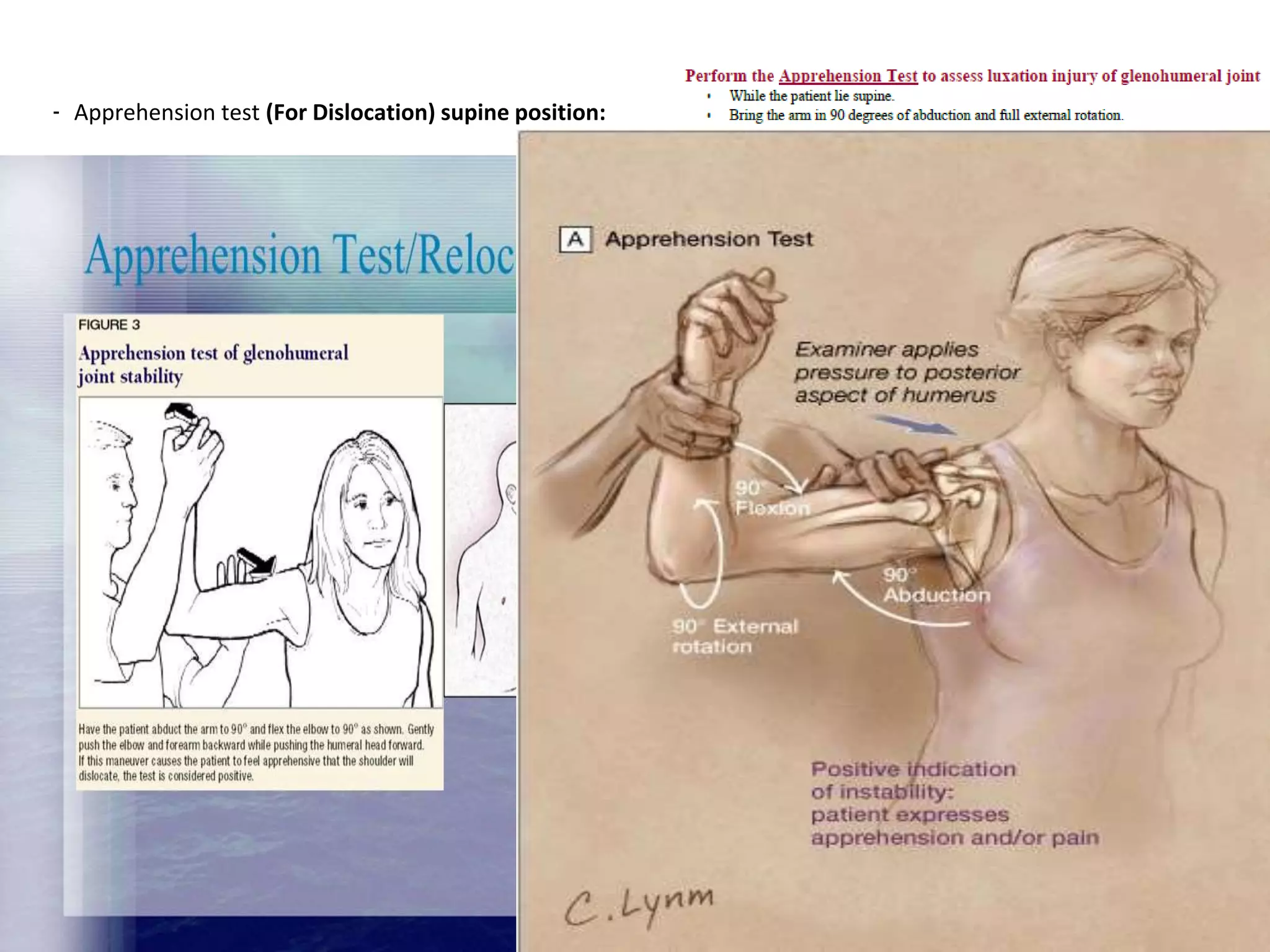 Shoulder Examination | PPT